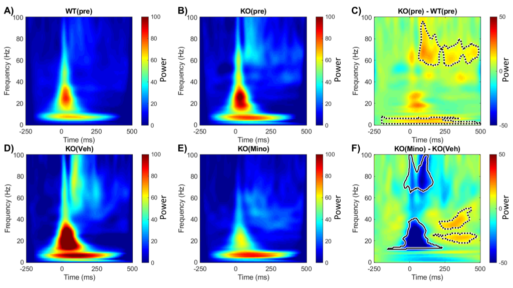 Results Reported: Using EEG Responses to Sound for Fragile X Drug ...