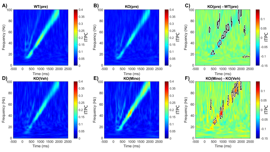 Results Reported: Using EEG Responses to Sound for Fragile X Drug ...