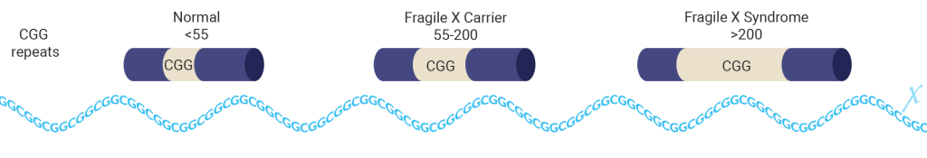 What Causes Fragile X Syndrome: Understanding the Genetic and Molecular ...