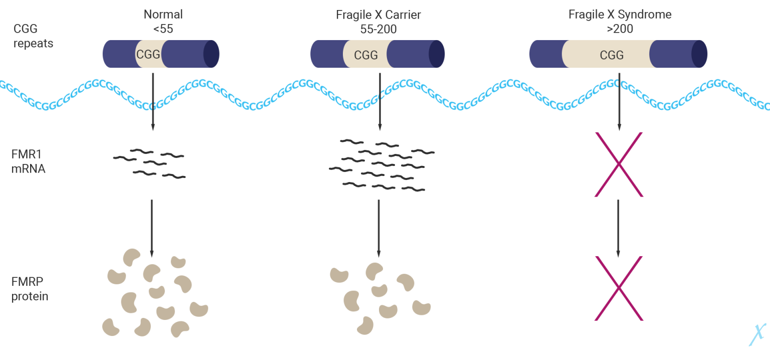What Causes Fragile X Syndrome: Understanding the Genetic and Molecular ...