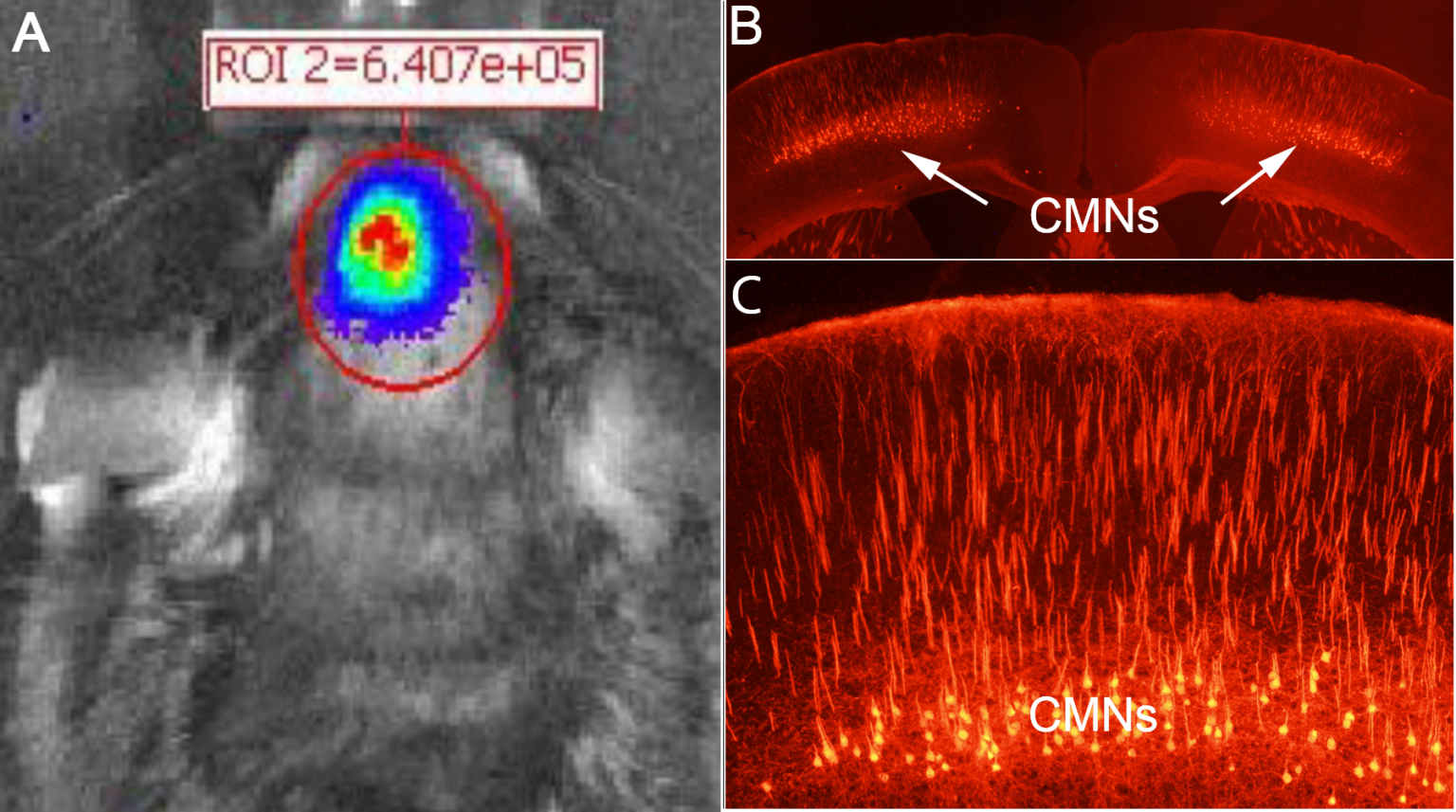 Targeting Cognitive Function in Fragile X Syndrome • FRAXA Research ...
