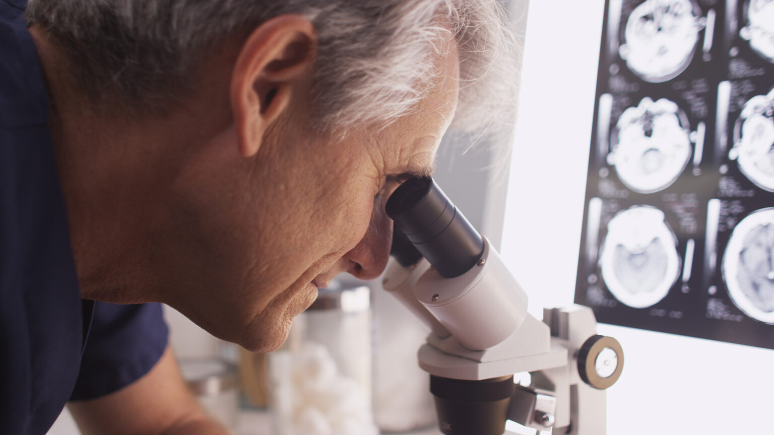 Fragile X and PDE Inhibitors: A Promising Path Forward for Brain ...